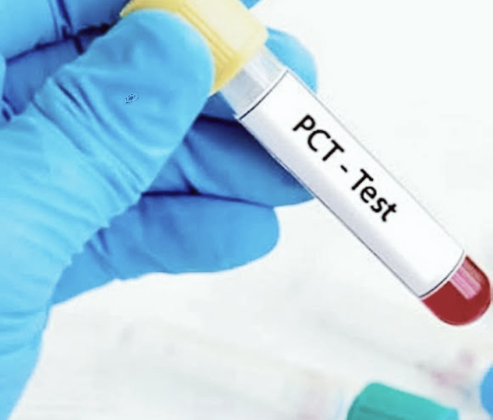 ما هو تحليل PCT ولماذا يطلب تحليل procalcitonin